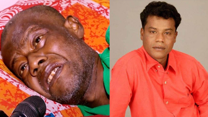 বাঁচানো গেল না গায়ক আকবরের পা